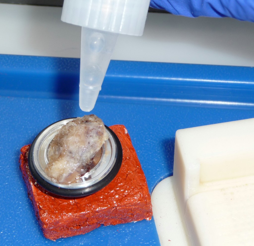 Portable gross digital pathology close up image device - GROSS PATHOLOGY